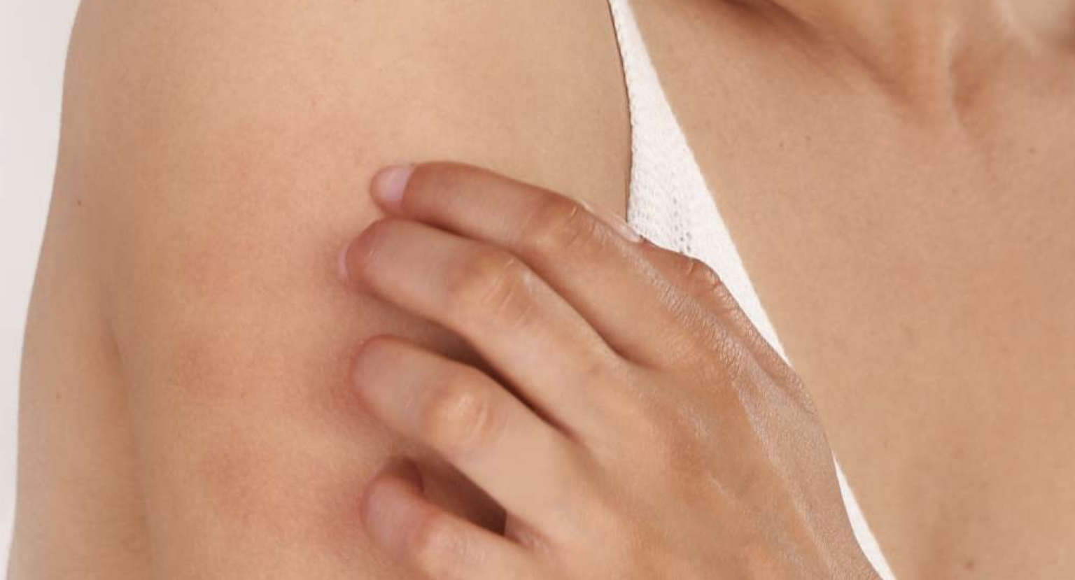 Jeukende huid, hoe ontstaan het en hoe kom je er vanaf